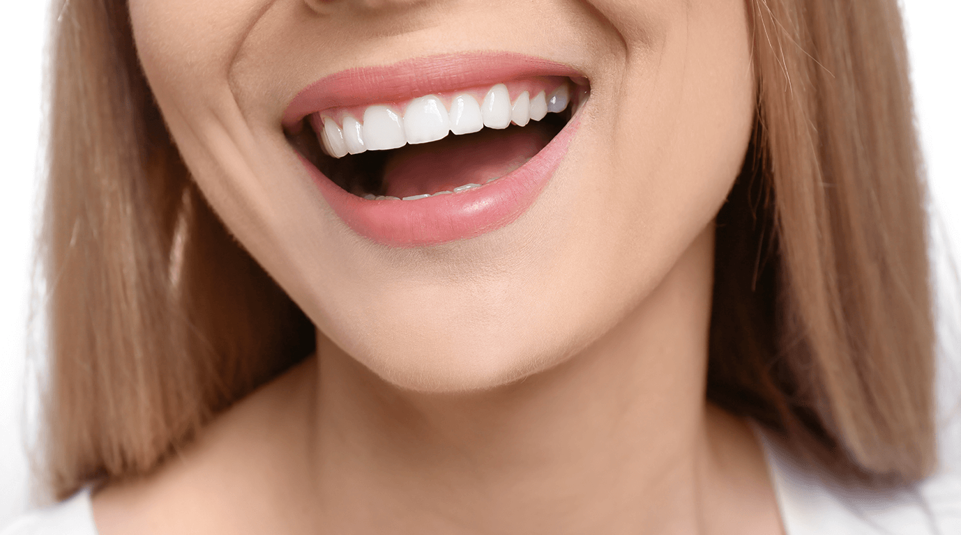 Hollywood Smile: The Secret to a Beautiful and Confident Smile - Dream Med